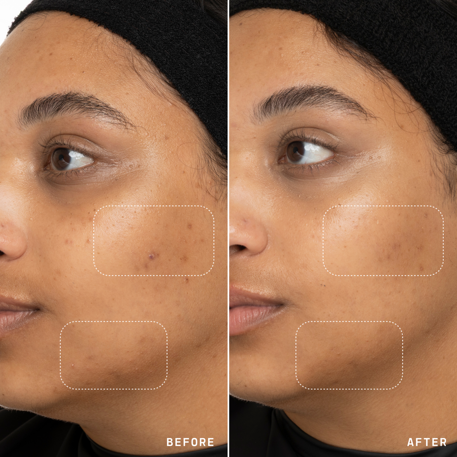 Skin Refine